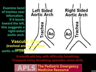 Apls Pediatric Emergency Radiology 2 | PPT