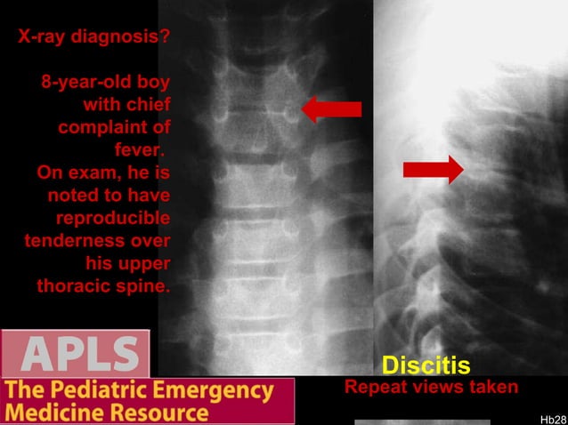 Apls Pediatric Emergency Radiology 2 | PPT