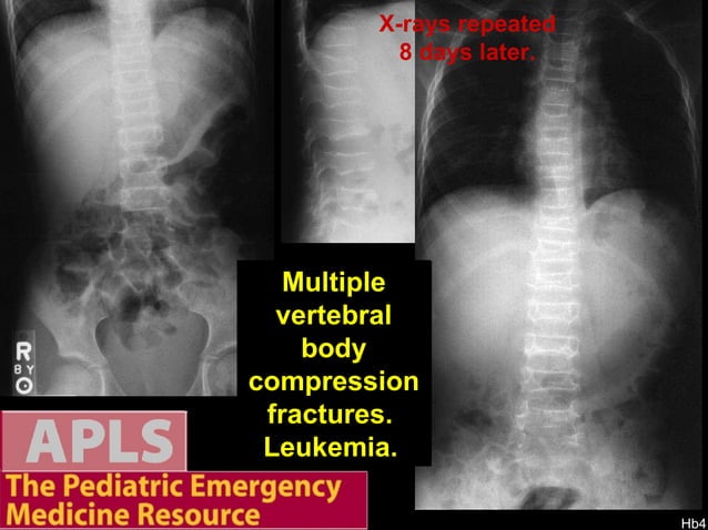Apls Pediatric Emergency Radiology 2 | PPT