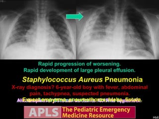 Apls Pediatric Emergency Radiology 2 | PPT