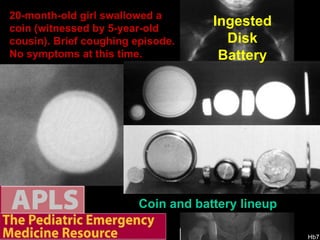 Apls Pediatric Emergency Radiology 2 | PPT