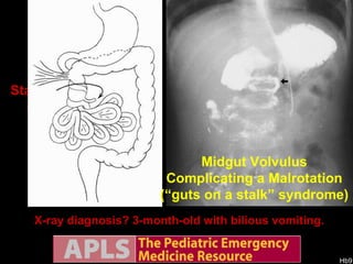Apls Pediatric Emergency Radiology 2 | PPT