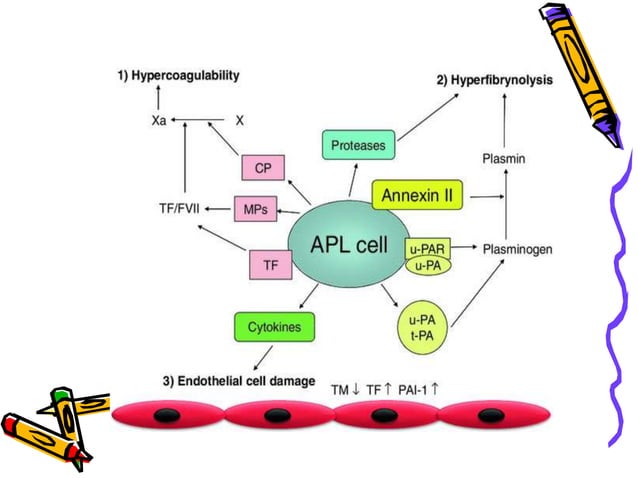 Acute Promyelocytic Leukaemia | PPTX | Blood Disorders | Diseases and ...