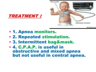 APNEA.ppt