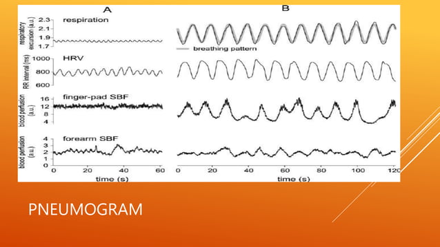 Apnea of prematurity | PPTX | Lung and Respiratory Health | Diseases ...
