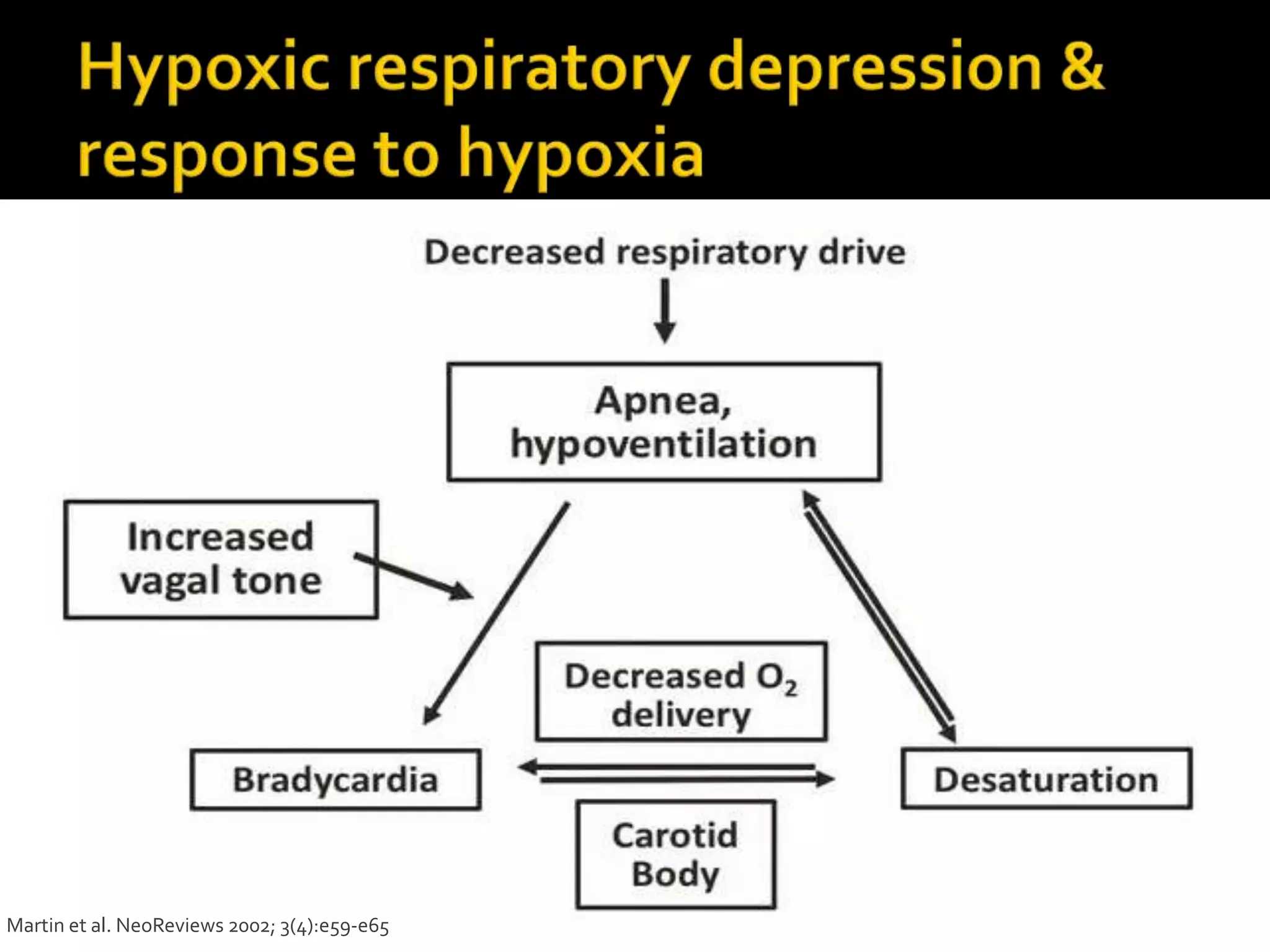 Apnea of prematurity | PPTX