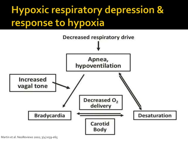 Apnea of prematurity | PPTX | Ear, Nose and Throat Conditions ...