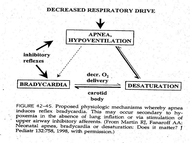 Apneaof Prematurity Detailedt