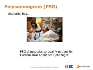 Apnea rx diagnostic protocol final | PPTX | Ear, Nose and Throat ...