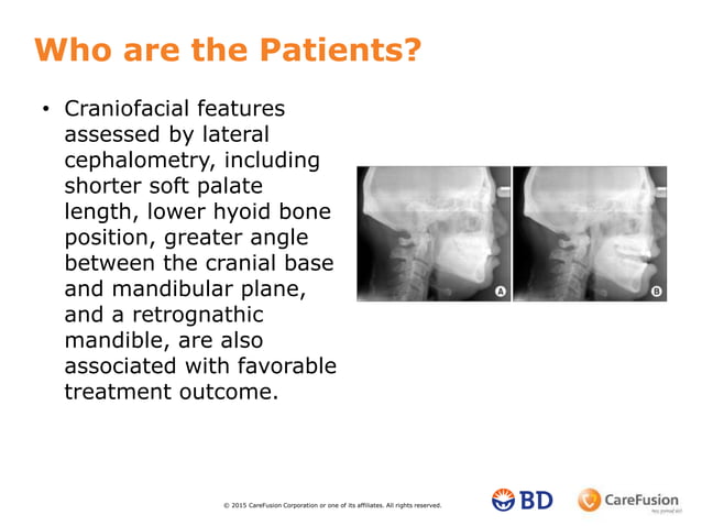 Apnea rx diagnostic protocol final | PPTX | Ear, Nose and Throat ...