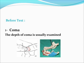 Apnea test by Hawra Owiwi | PPT