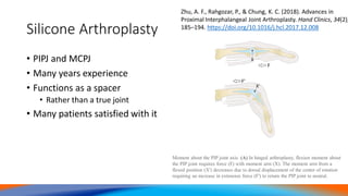 PIPJ Post-traumatic Arthritis: Arthrodesis vs Arthroplasty | PDF