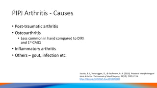 PIPJ Post-traumatic Arthritis: Arthrodesis vs Arthroplasty | PDF