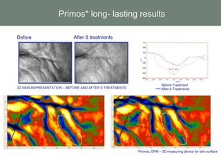 Before and After- Apollo | PPTX