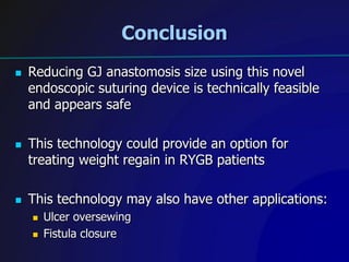 Stomal reduction with Apollo Overstitch | PDF | Digestive Disorders ...