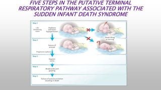 Sudden infant death syndrome. | PPTX