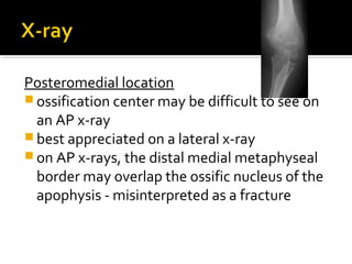 Apophyseal injuries of elbow , medial epicondyle avulsion fractures | PPT