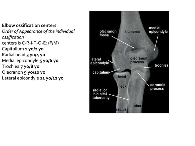 Apophyseal injuries of elbow , medial epicondyle avulsion fractures