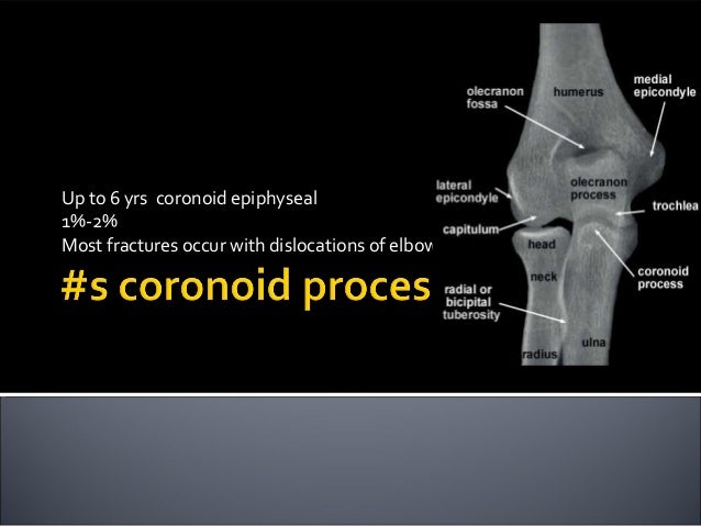 Apophyseal injuries of elbow , medial epicondyle avulsion fractures