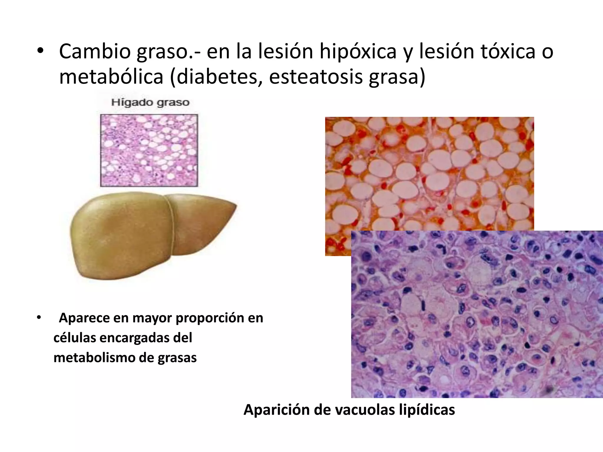 Apoptosis | PPTX