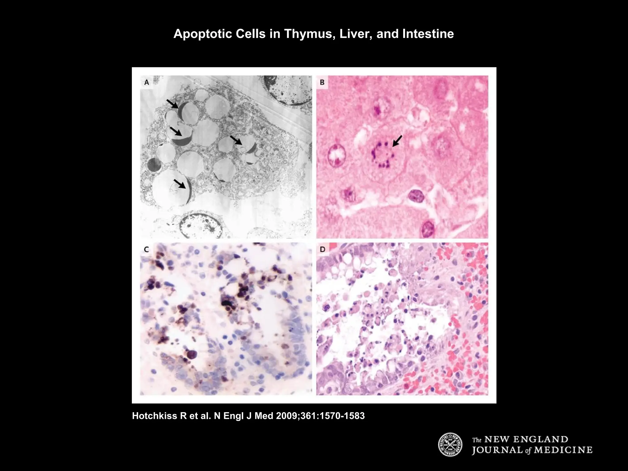 APOPTOSIS / cell death / programmed cell death | PPT