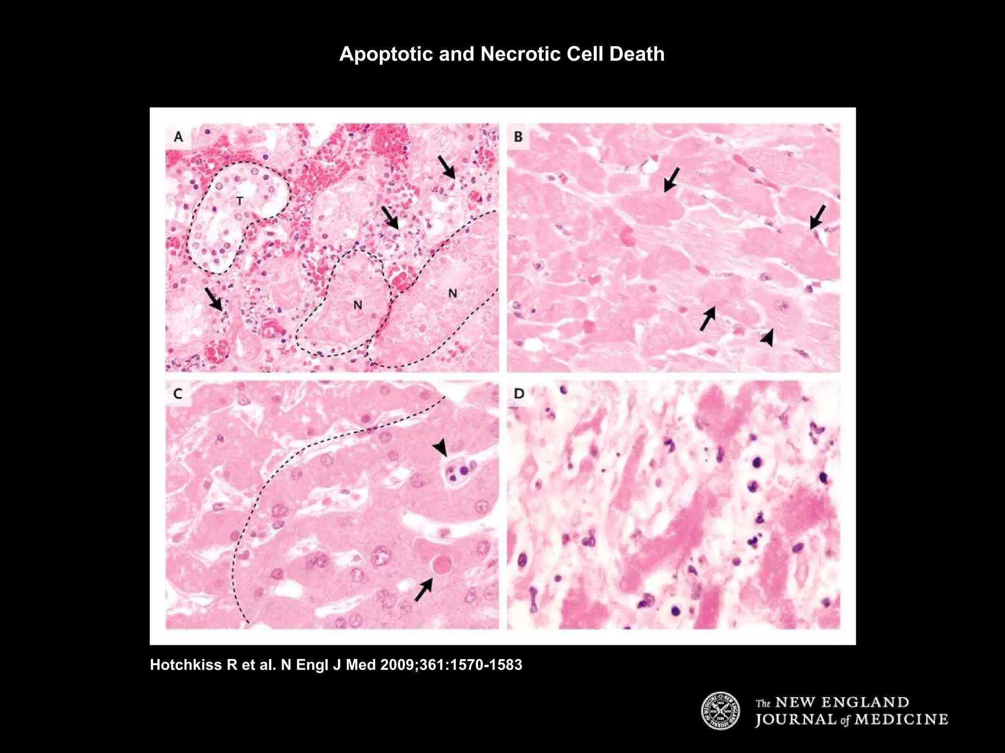 APOPTOSIS / cell death / programmed cell death | PPT APOPTOSIS / cell death / programmed cell death | PPT