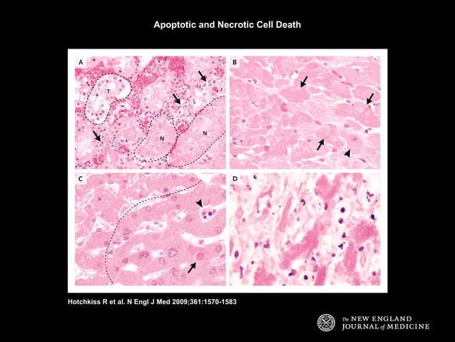 APOPTOSIS / cell death / programmed cell death | PPT