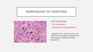 apopwqgdcbhuredgbcfyhhvhcctosis (1).pptx