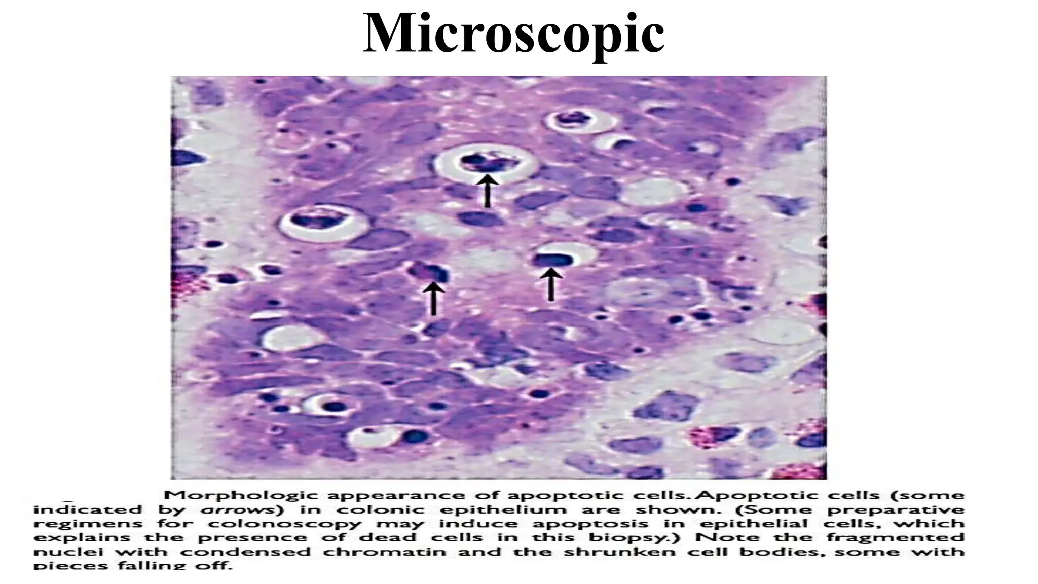 Apoptosis pathology medical laboratory' (1).pptx