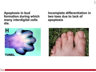 Apoptosis and cancer stem cell | PPT