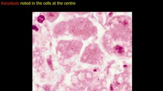 APOPTOSIS AND NECROSIS OF THE HUMAN BODY.pdf