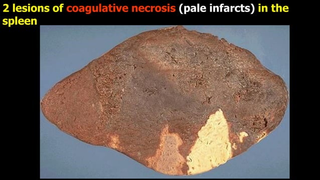 APOPTOSIS AND NECROSIS OF THE HUMAN BODY.pdf