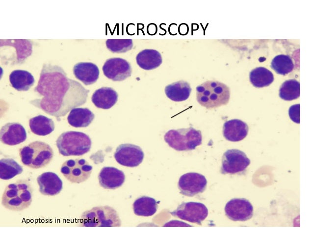 Apoptosis in health and diseases