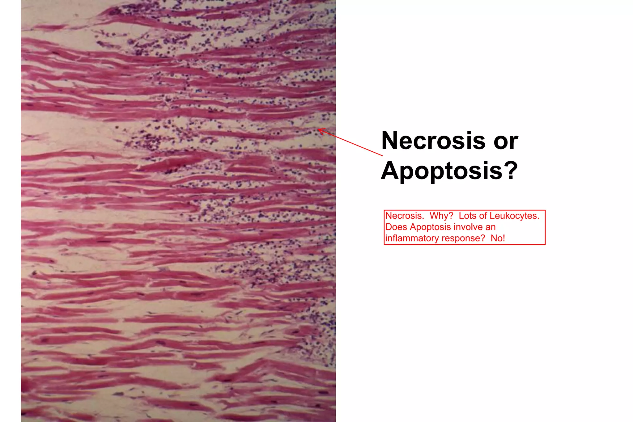 apoptosis lecture-powerpoint slides (1) (1).pdf | Biological Sciences ...