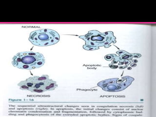 Apoptosis made easy | PPTX