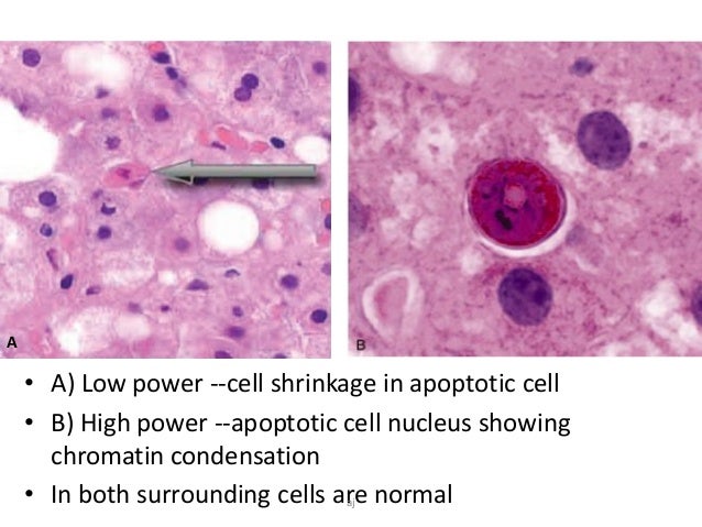 Apoptosis basics + microphotographs