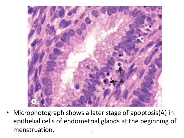 Apoptosis basics + microphotographs