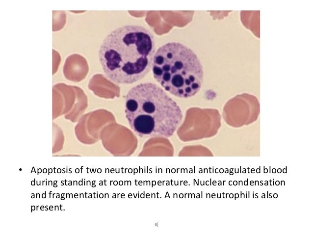 Apoptosis basics + microphotographs