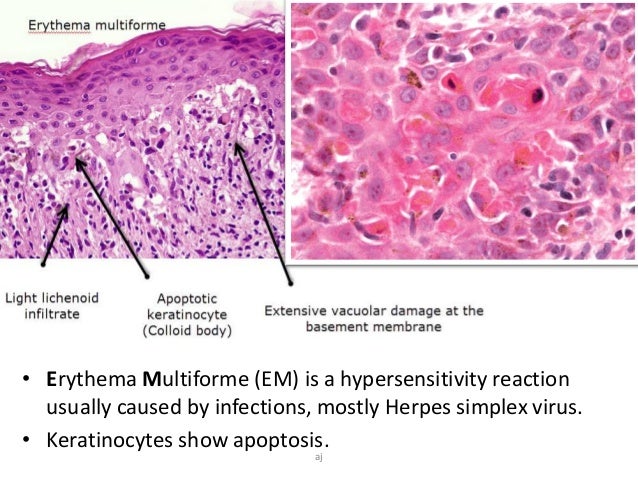 Apoptosis basics + microphotographs