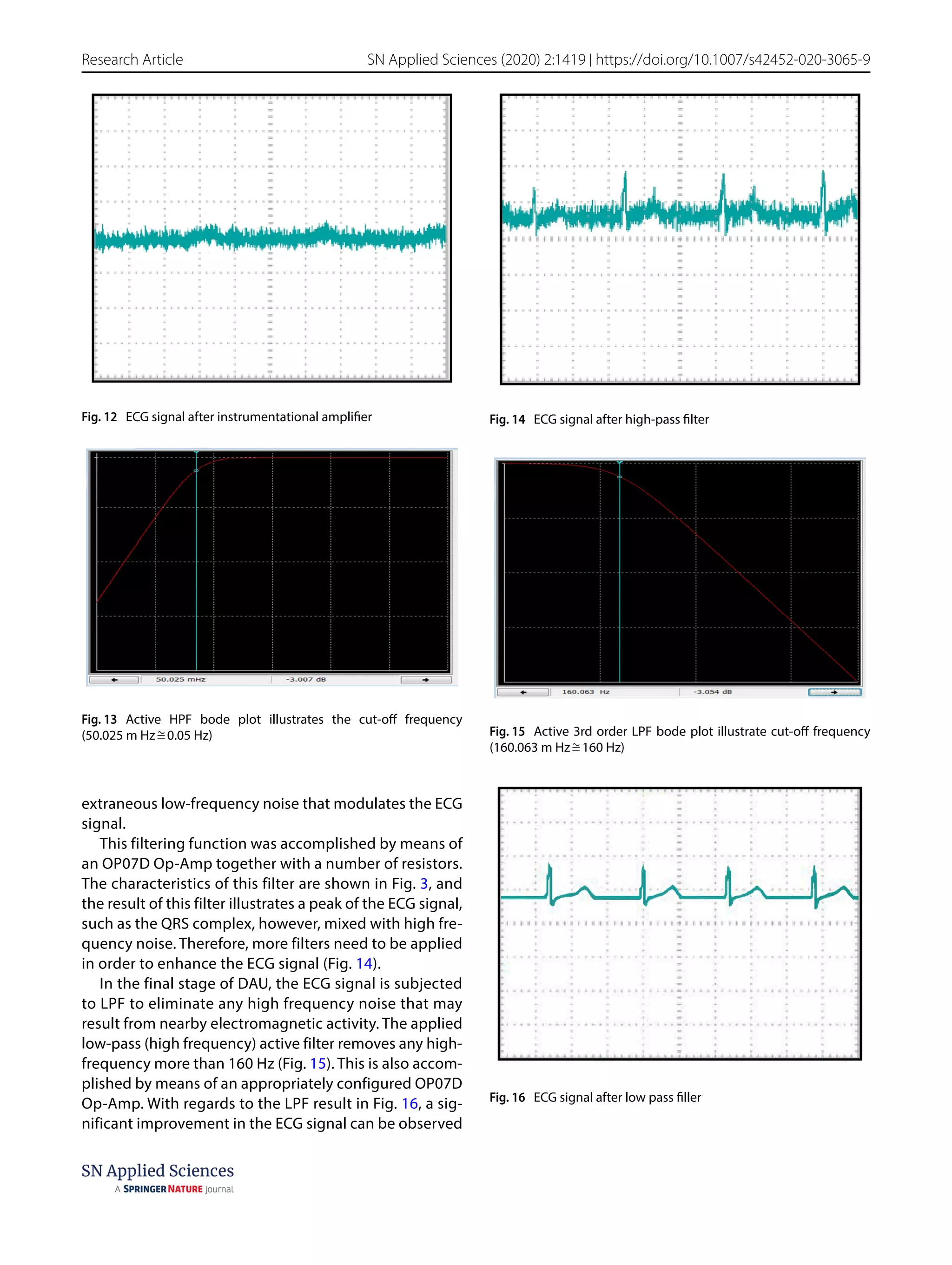 A Portable Electrocardiogram For Real‑time Monitoring Of Cardiac Pdf Heart And