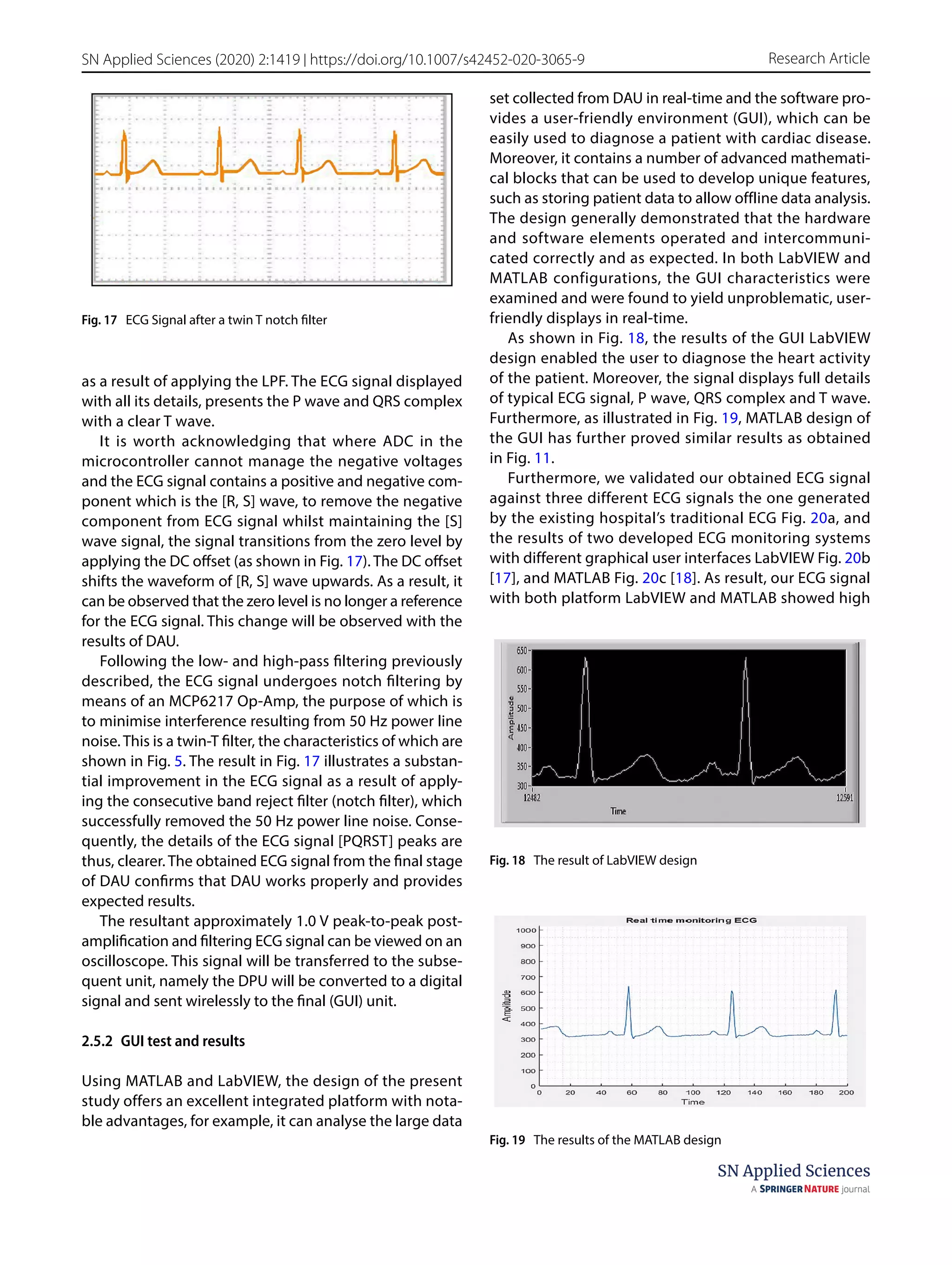 A Portable Electrocardiogram For Real‑time Monitoring Of Cardiac Pdf Heart And