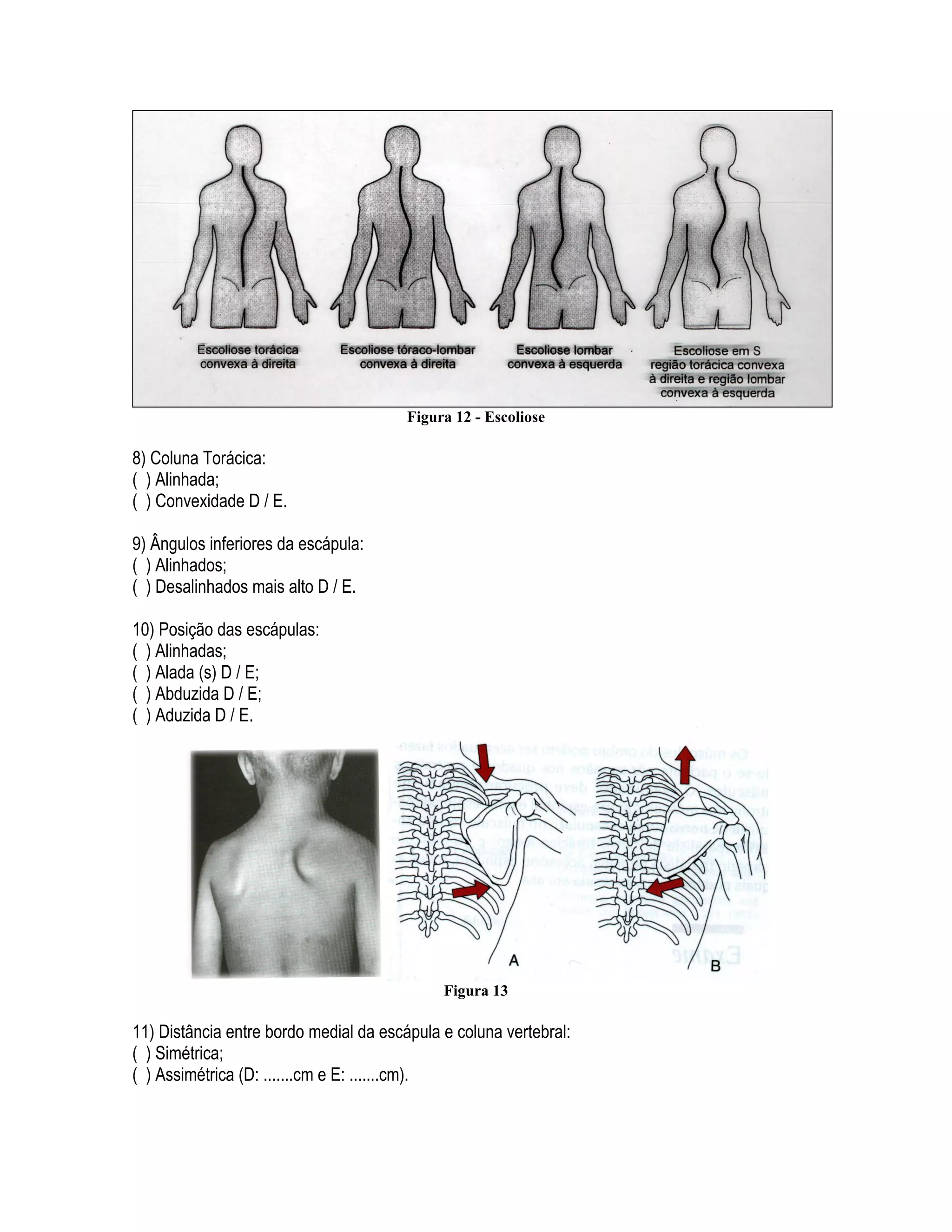 Avaliação Postural - Apostila | PDF