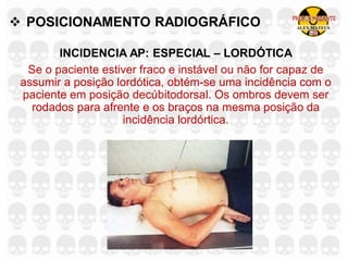 APOSTILA PROF. IONIZANTE - INCIDÊNCIA RADIOGRÁFICA | PDF
