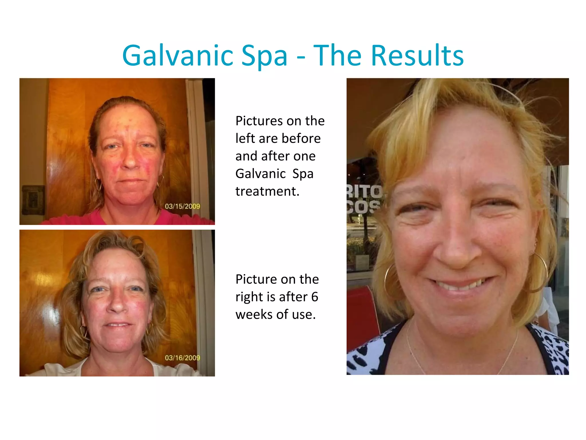 Many before and after photos showing the power of ageLOC technology | PPT