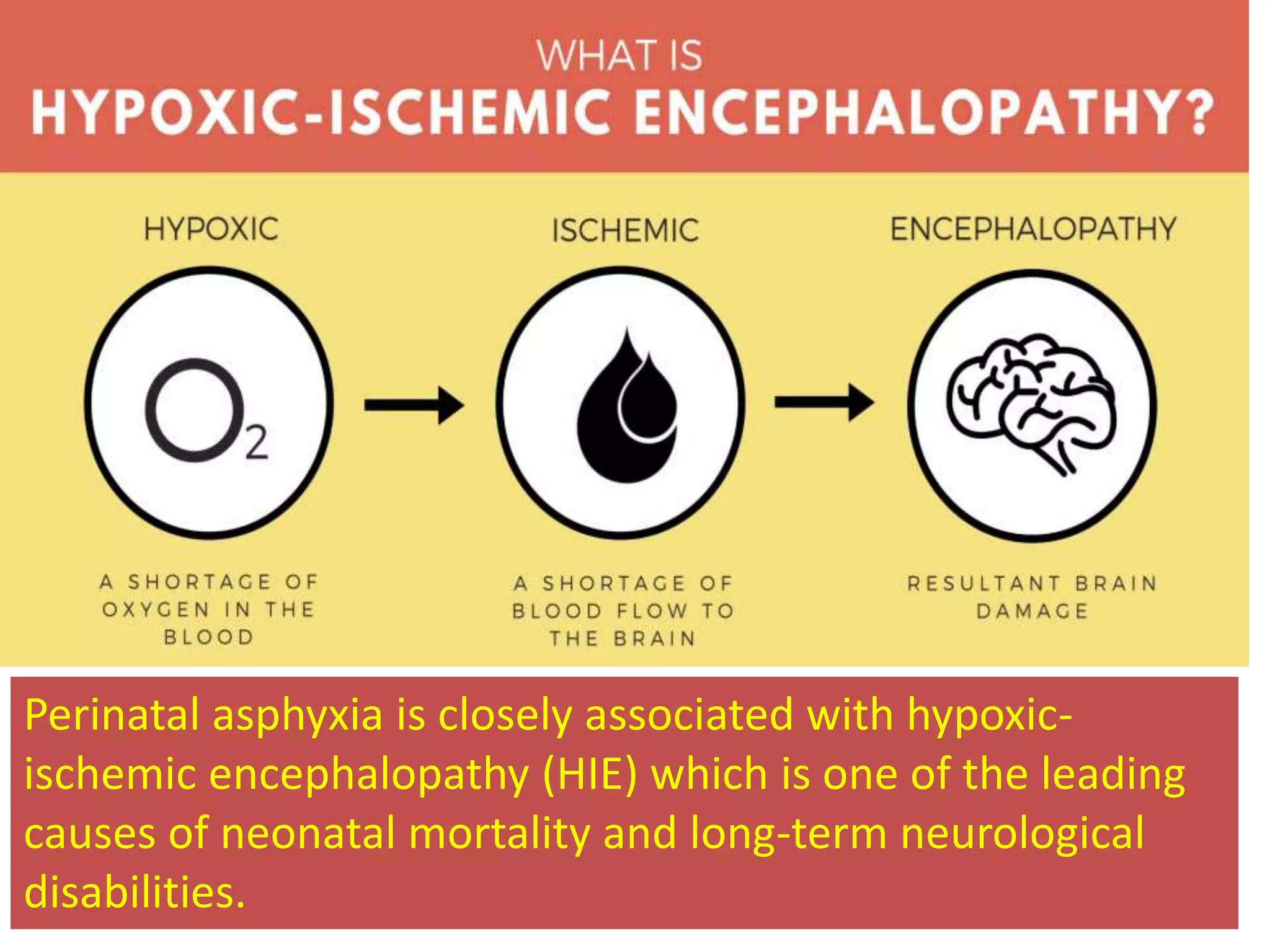 Asphyxia Neonatorum by Shagufta Nisar | PPTX