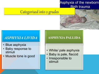 Asphyxia Neonatorum by Shagufta Nisar | PPTX