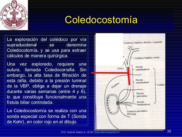 Apoyo docencia-colecistectomia-ucsc