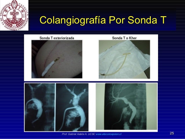 Apoyo docencia-estudio viabiliar-ucsc