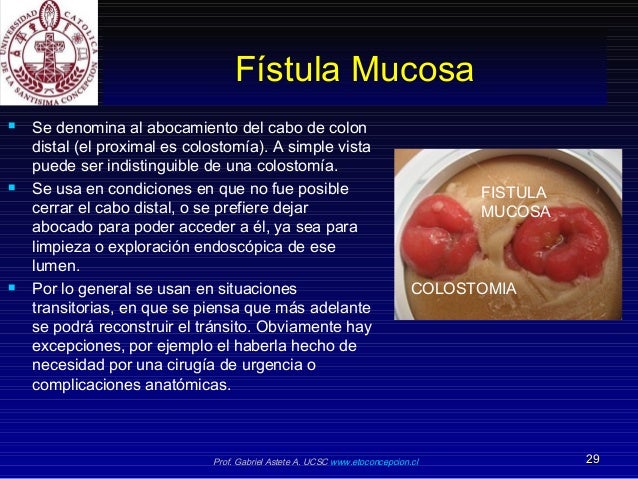 Apoyo docencia-reconstruccion transito-cd-baja-ucsc