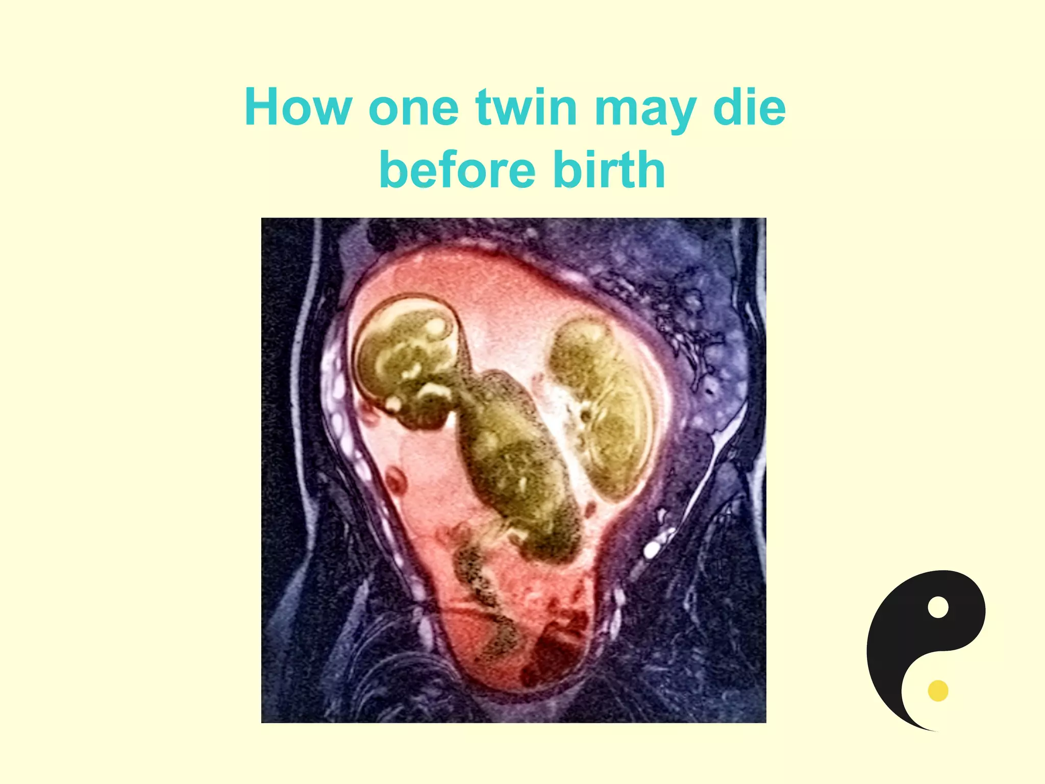 Towards a psychological profile for womb twin survivors | PPT